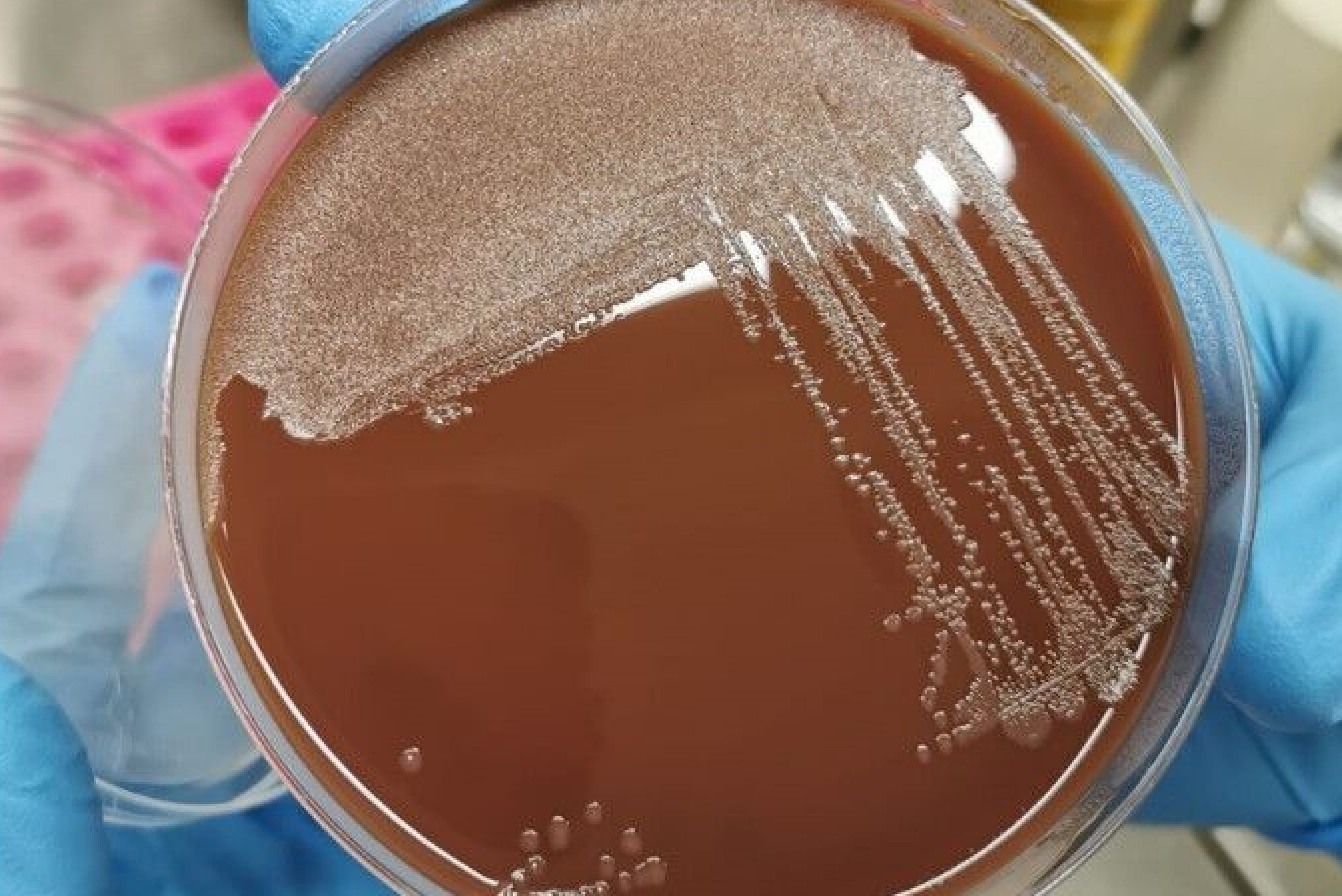 Infektionen mit antibiotikaresistenten Haemophilus influenzae Bakterien ...